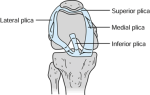 ROLE OF PHYSIOTHERAPY IN SYNOVIAL PLICA SYNDROME OF KNEE MANAGEMENT ...